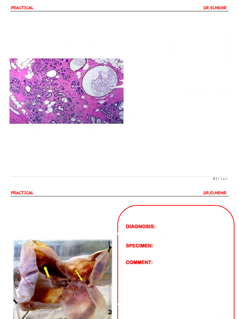 Patho Rearranged-Flattened | PDF | Uterus | Ovary