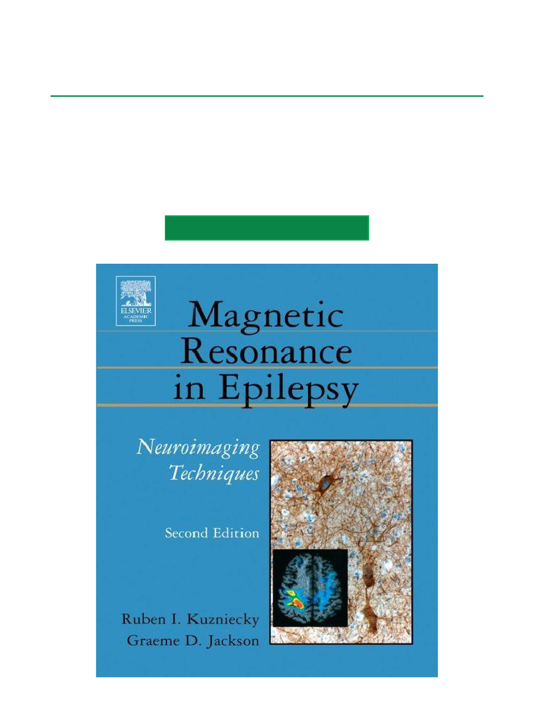 Brain Plasticity and Epilepsy A Tribute To Frank Morrell A Tribute To ...