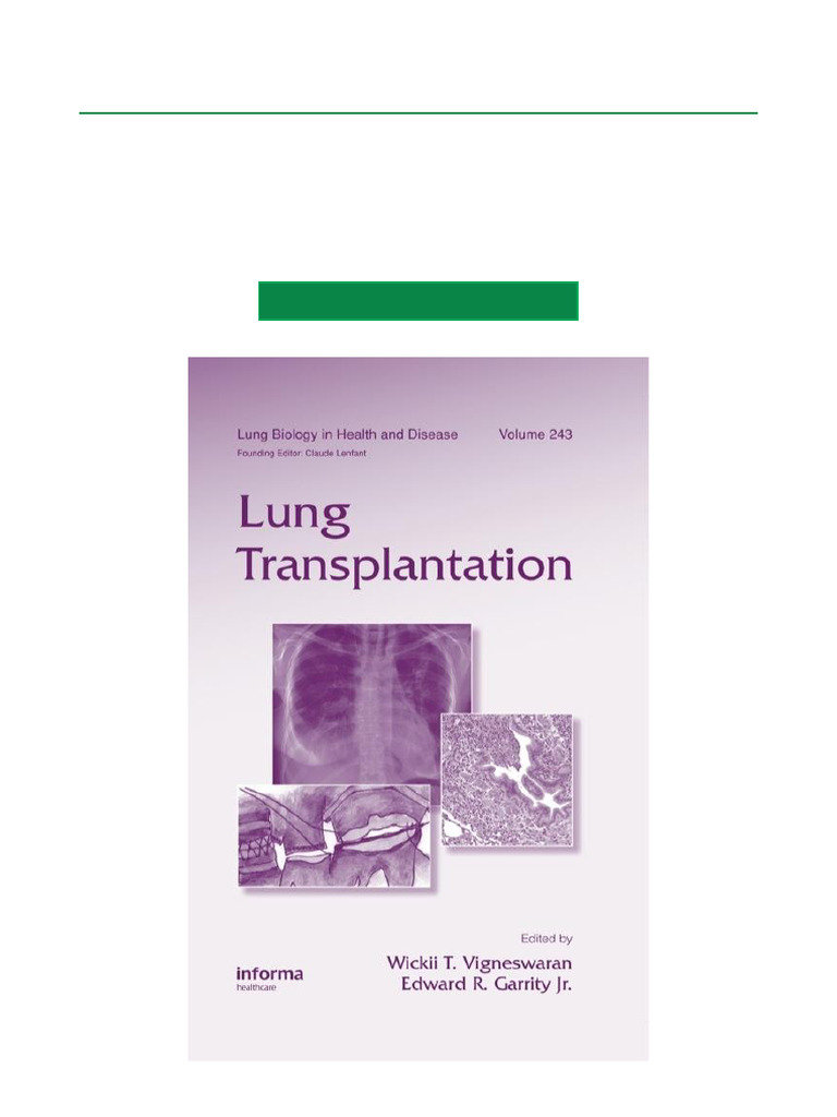 Lung Transplantation, 1st Edition Accessible DOCX Download | PDF | Organ Transplantation ...