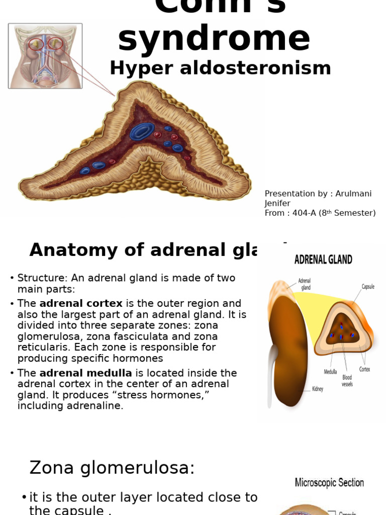 Conn's Syndrome | PDF | Adrenal Gland | Endocrine System
