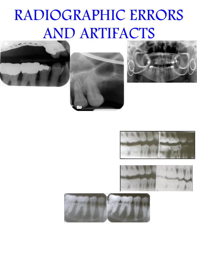14 Radiographic Errors and Artifacts 14 2023.PDF - 2023.02.07 - 08.57 ...