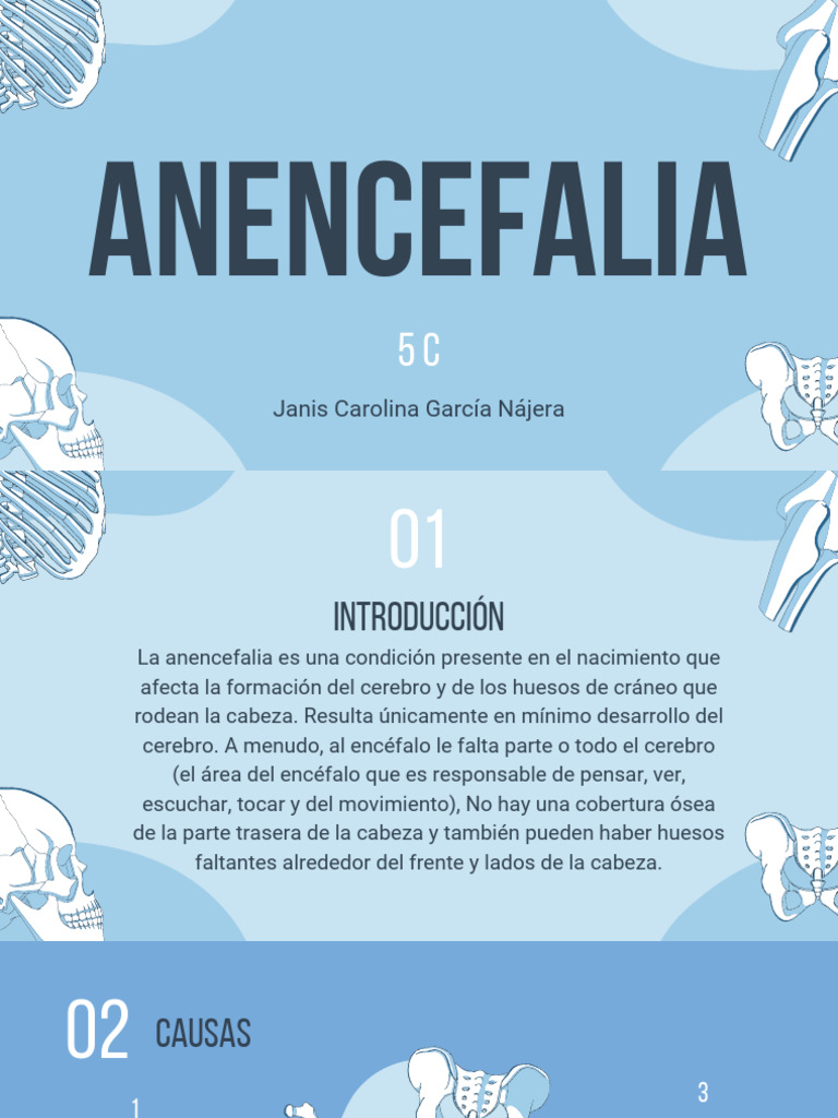 Anencefalia Presentación | PDF | Enfermedades y trastornos ...