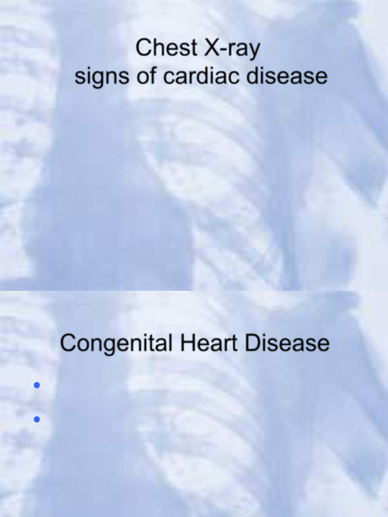 Heart Disease X-Ray Findings | PDF | Heart | Congenital Heart Defect