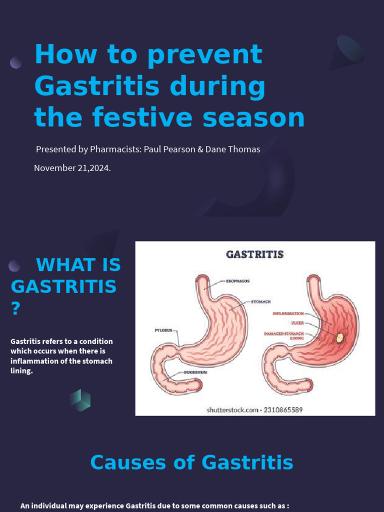 Preventing Gastritis This Holiday Season | PDF