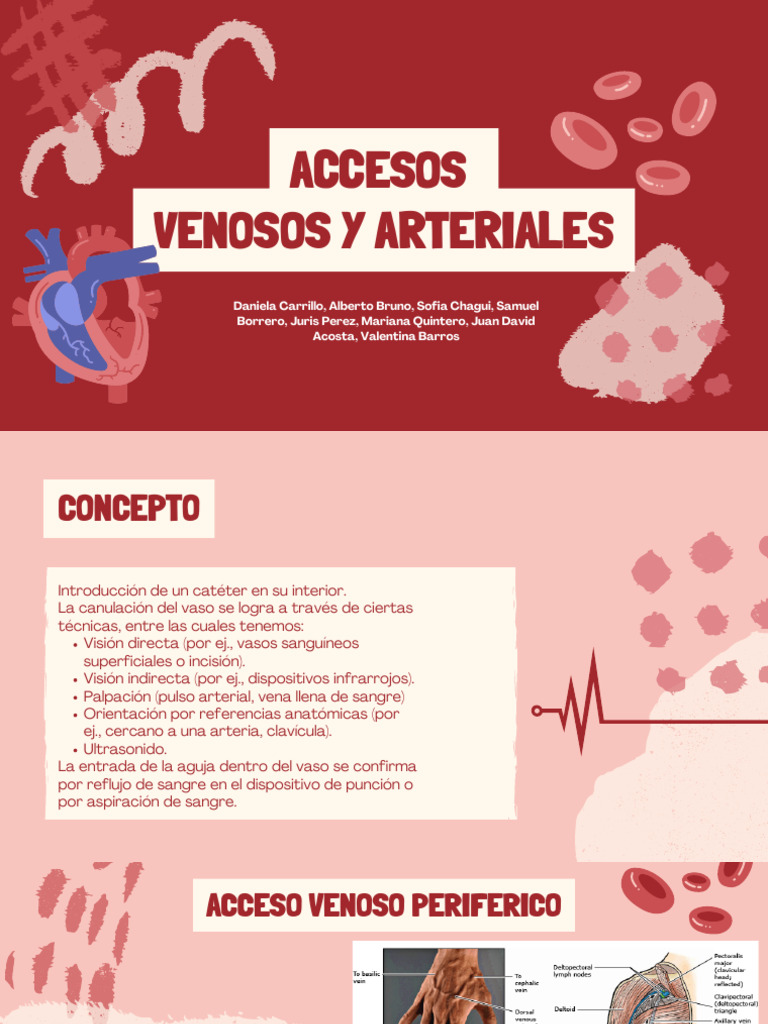 Accesos Venosos - 20250503 - 085824 - 0000 | PDF | Vena | Terapia intravenosa