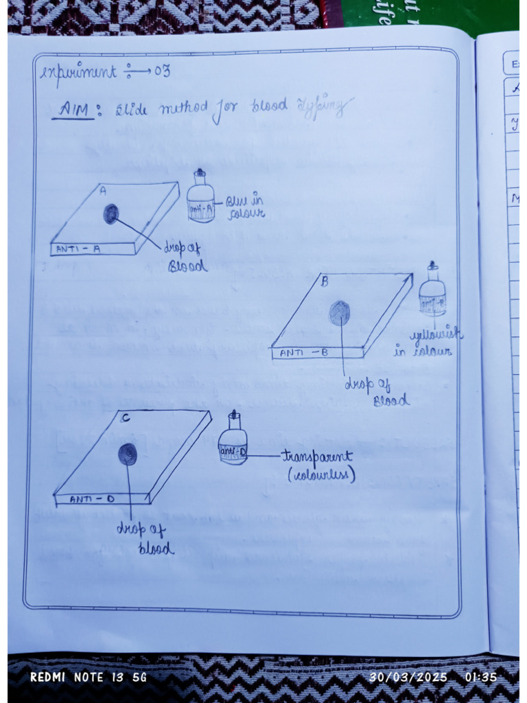 Hemato Epx 3 (Sem2) | PDF
