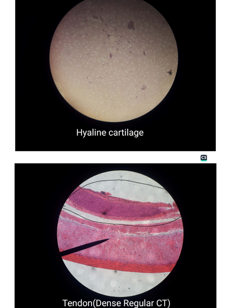 Histology of CT bone and cartilage | PDF