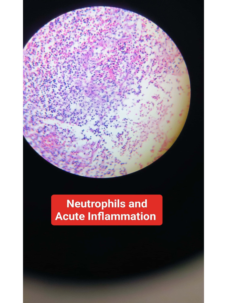 Pathology _Inflammation_AN | PDF