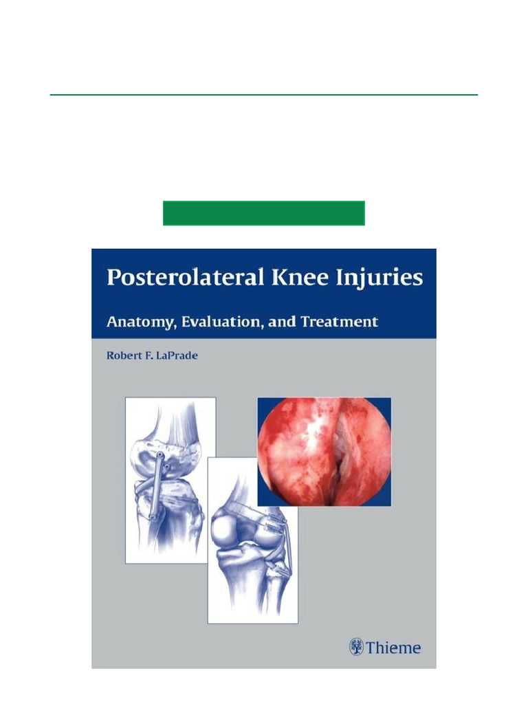 Posterolateral Knee Injuries Guide | PDF | Medicine