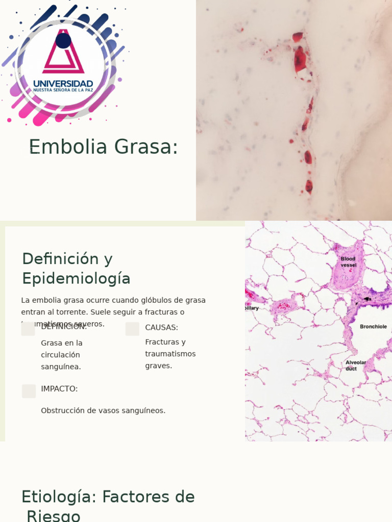 Embolia Grasa Un Vistazo Integral | PDF