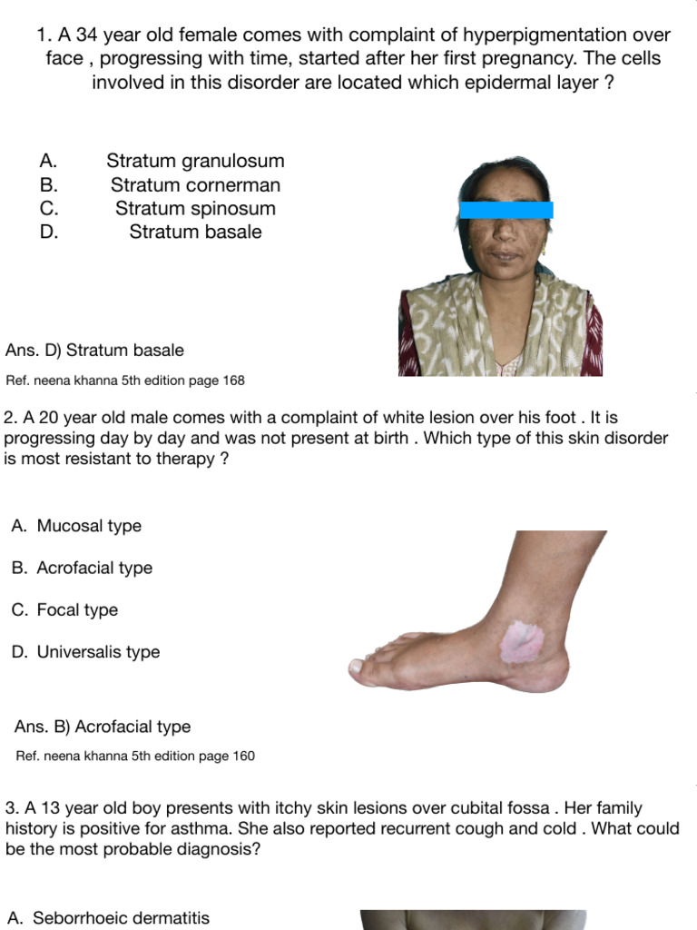 Skin Disorders and Diagnoses Quiz | PDF | Dermatitis | Human Diseases ...