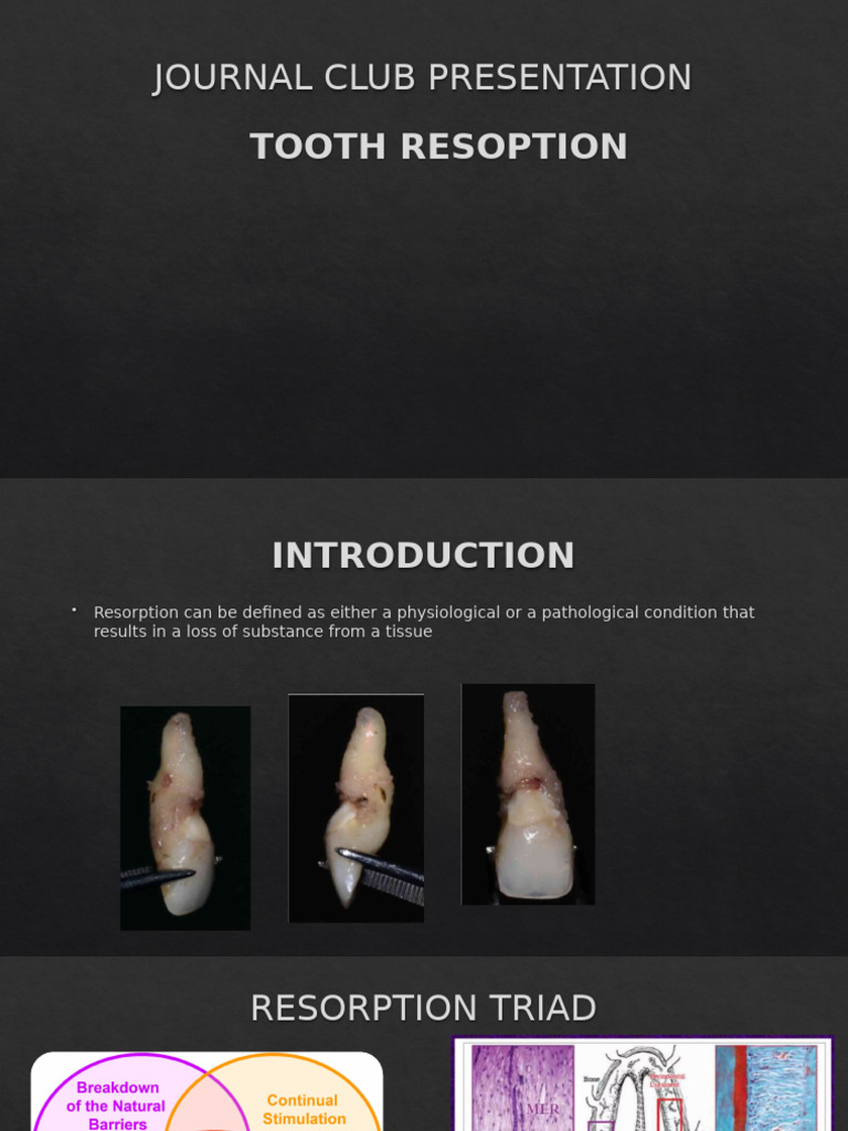 Tooth Resorption Journal Club Presentation | PDF | Human Tooth ...