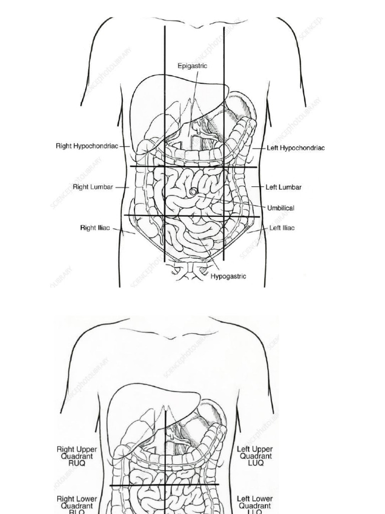 Ipprint Pag Trace An LNH | PDF