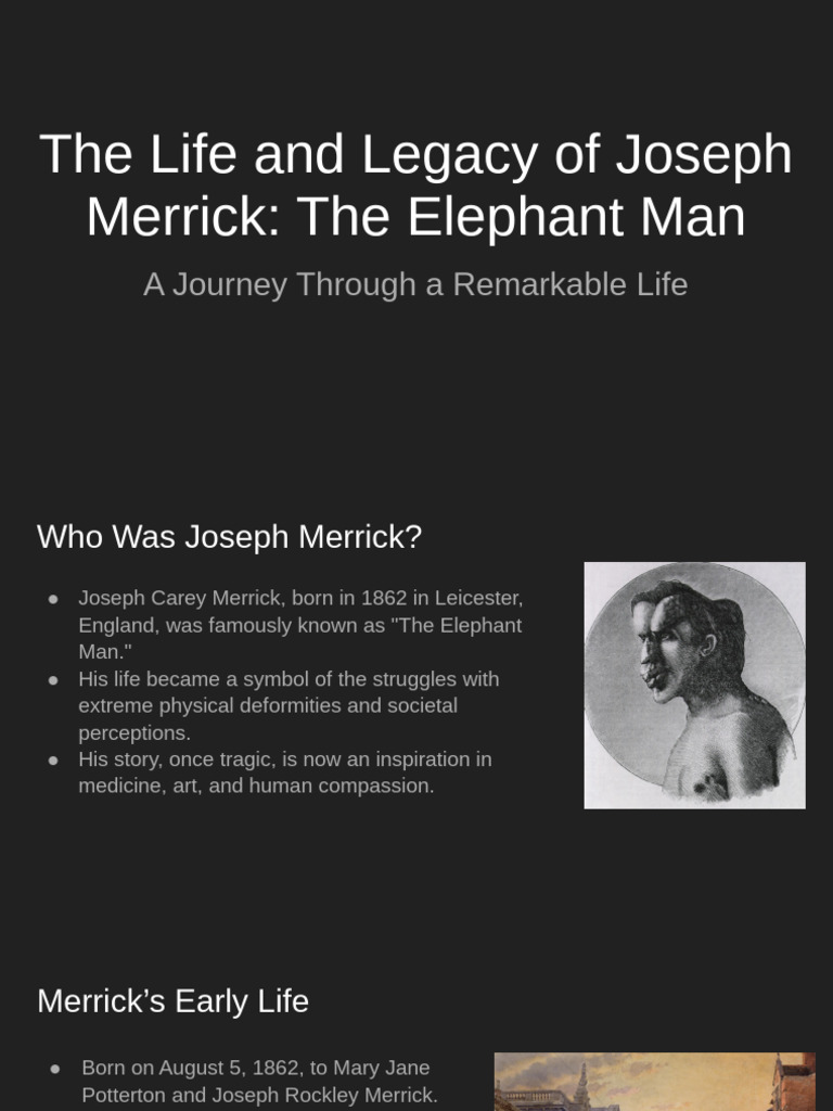 Joseph Merrick: Life of the Elephant Man | PDF