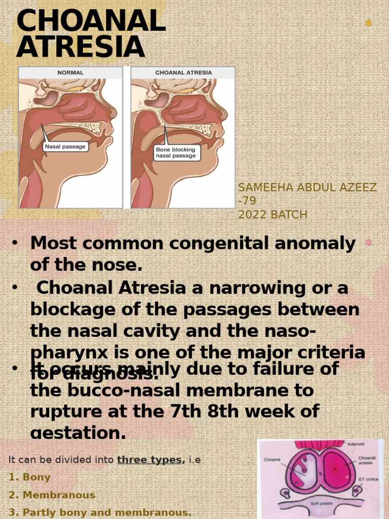Choanal Atresia (1) | PDF | Human Head And Neck | Medical Specialties