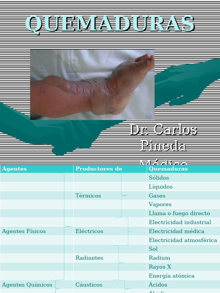 QUEMADURAS.pptx(1) | PDF | Quemar