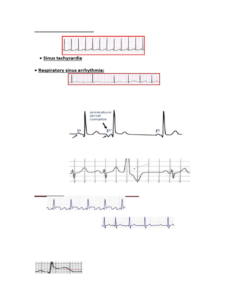 Important ECG Figures | PDF
