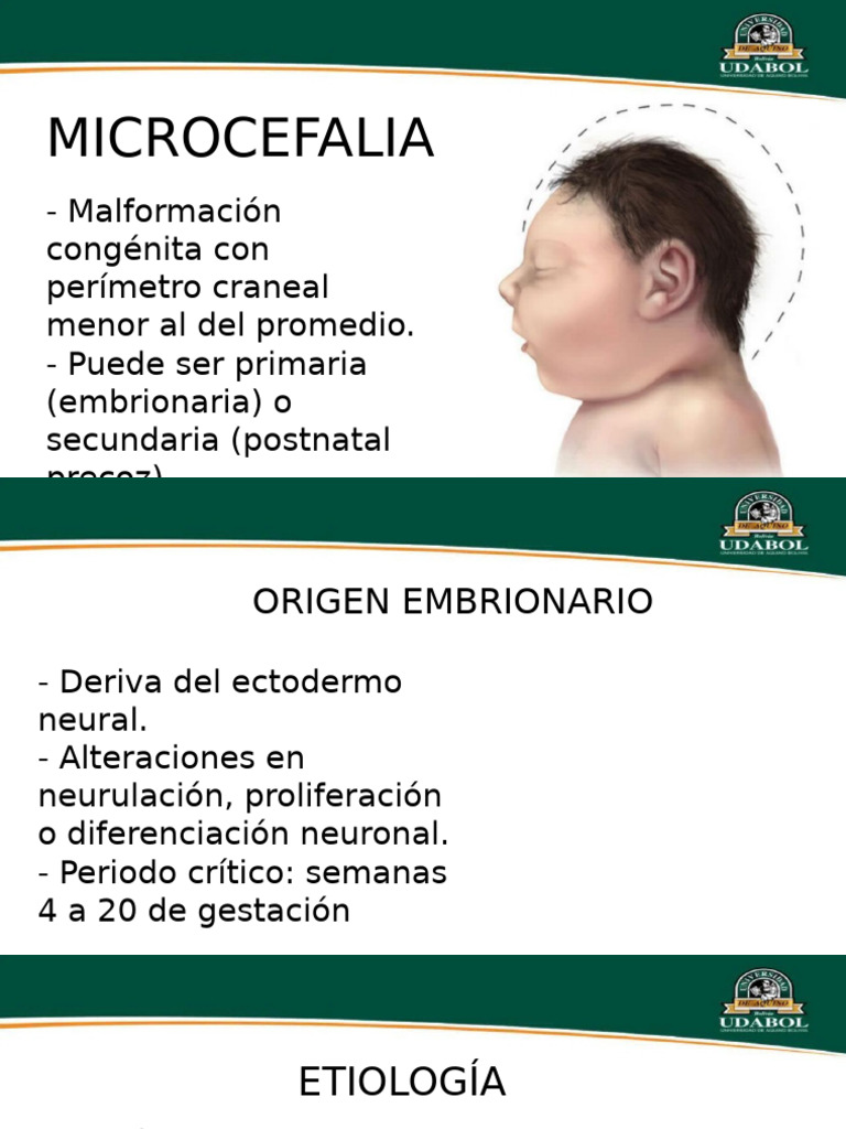 MICROCEFALIA | PDF