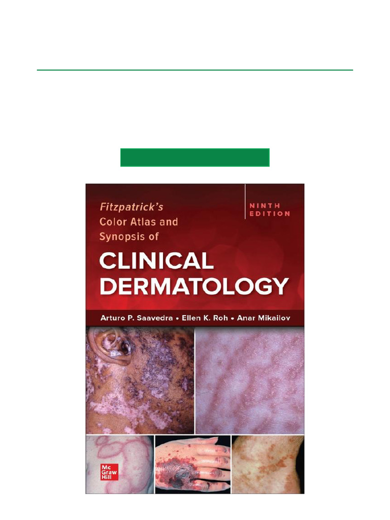 Fitzpatrick's Color Atlas and Synopsis of Clinical Dermatology 9th Edition Secure Download | PDF ...