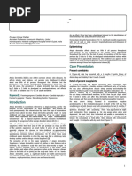 Hanifin and Rajka Criteria | PDF