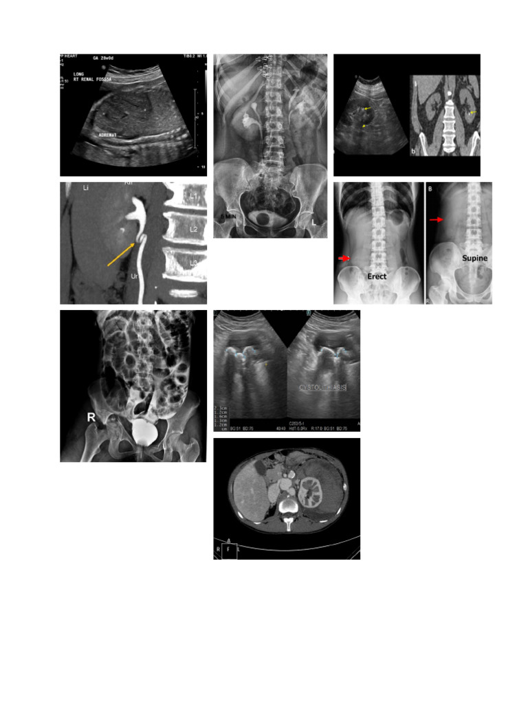 122 Lec Assignment Midterms | PDF