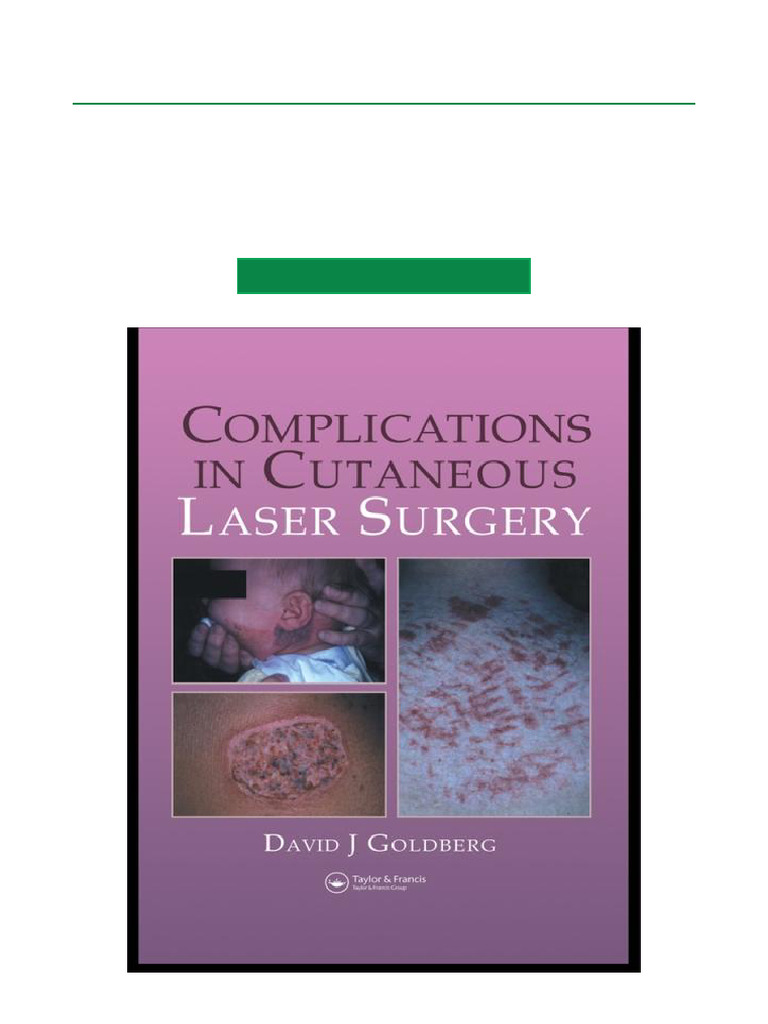 Complications in Laser Cutaneous Surgery 1st Edition Reference Book ...