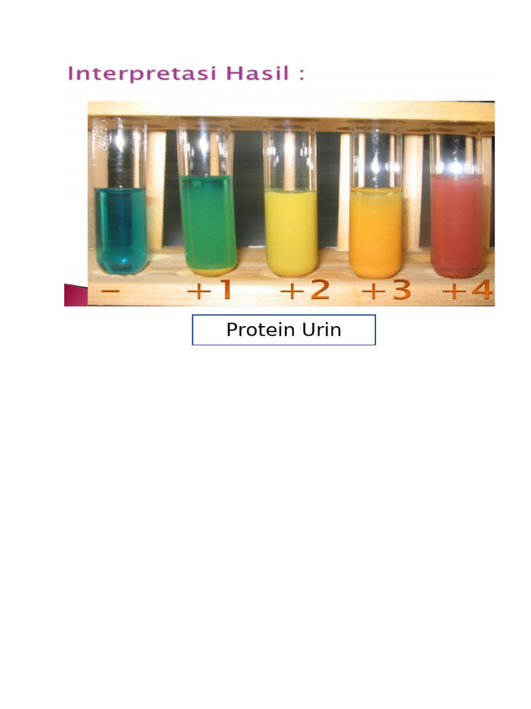 Gambar Protein Urin Manual | PDF