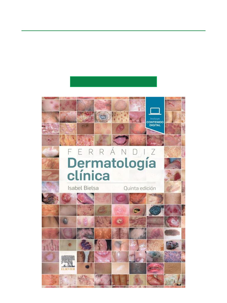 Ferrándiz. Dermatología Clínica - 5th Edition Complete Chapter Download | PDF | Epidermis | Piel