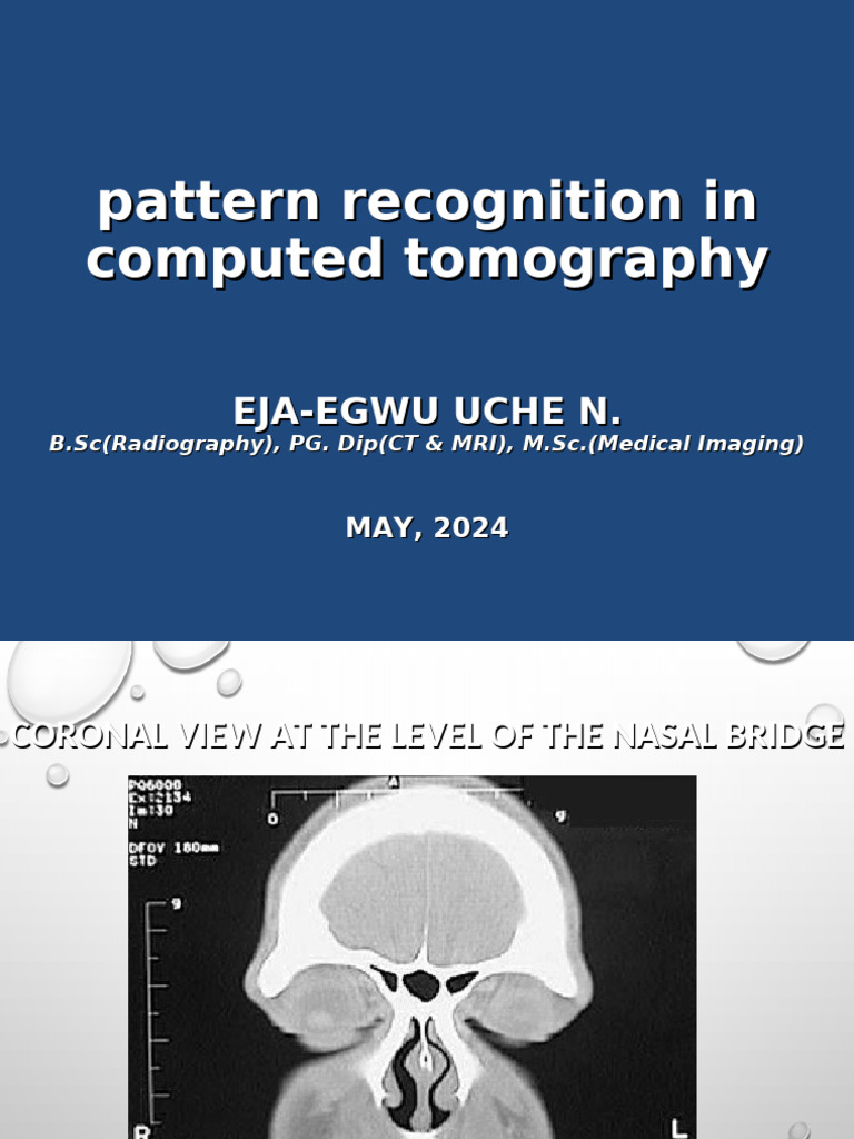 CT CROSS SECTIONAL ANATOMY & Pattern Recognition | PDF | Ct Scan | Abdomen