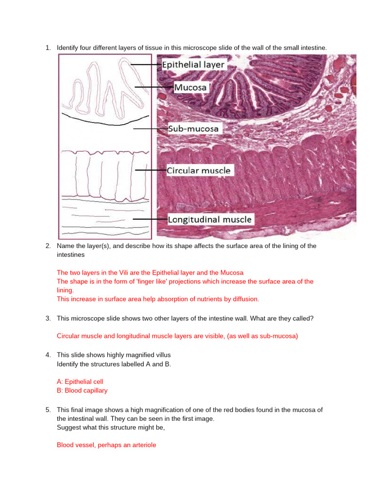 AnswersToStructures of Intestine& Villi Worksheet | PDF