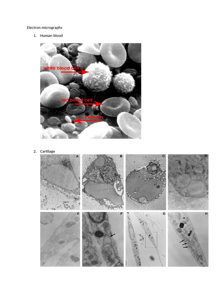 Electron Micrographs of Cell Organelles | PDF