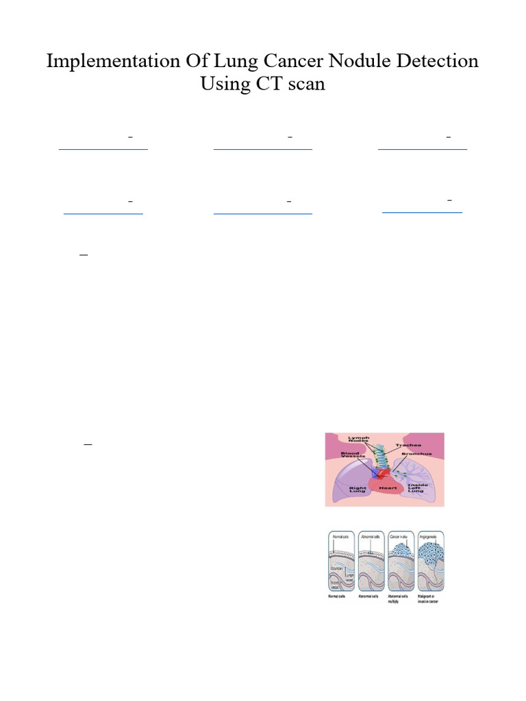 Lung Cancer Nodule Detection Ieee Paper Pdf Ct Scan Image