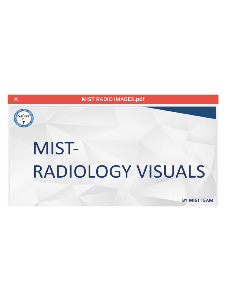 mist radiology images | PDF
