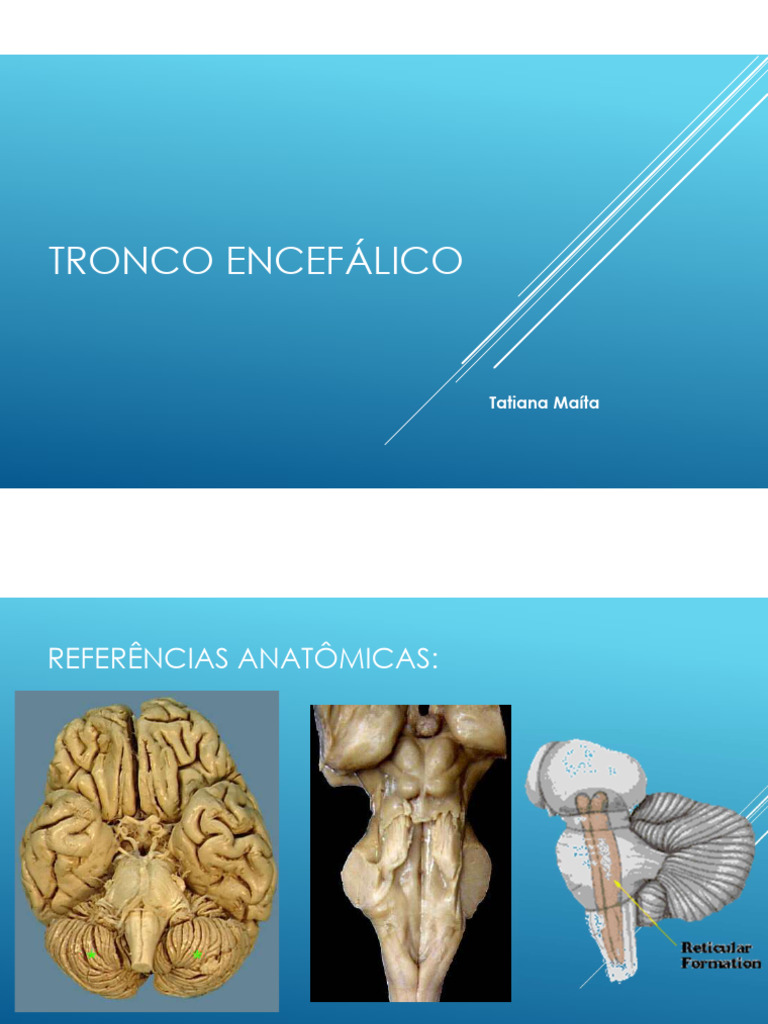 Aula Tronco Encefalico 2024.2 | PDF | Nervo | Olho humano