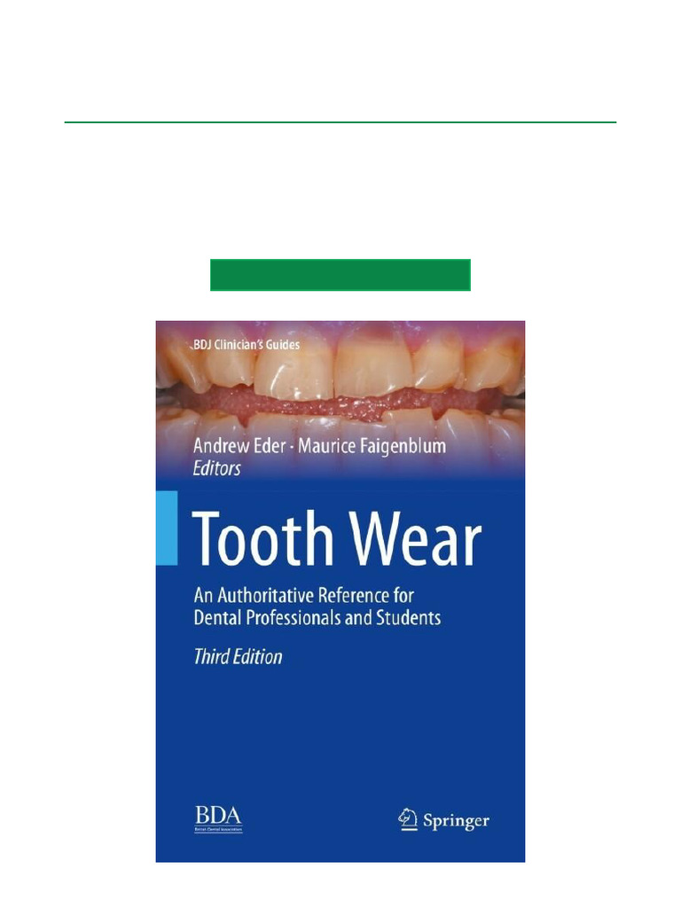 Tooth Wear An Authoritative Reference for Dental Professionals and ...
