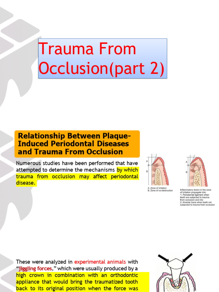 Perio5 Lec. Trauma From Occlusion P.2 | PDF | Periodontology | Human Tooth