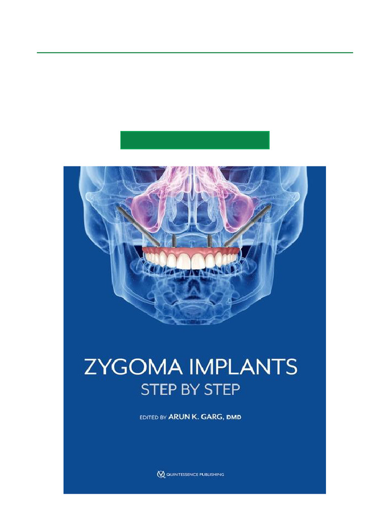 Zygoma Implants Step by Step 1st Edition Full Digital Edition | PDF | Dental Implant | Dental Degree
