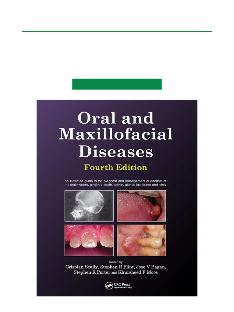 Oral and Maxillofacial Diseases 4th Edition Full Text | PDF | Congenital Heart Defect | Human ...