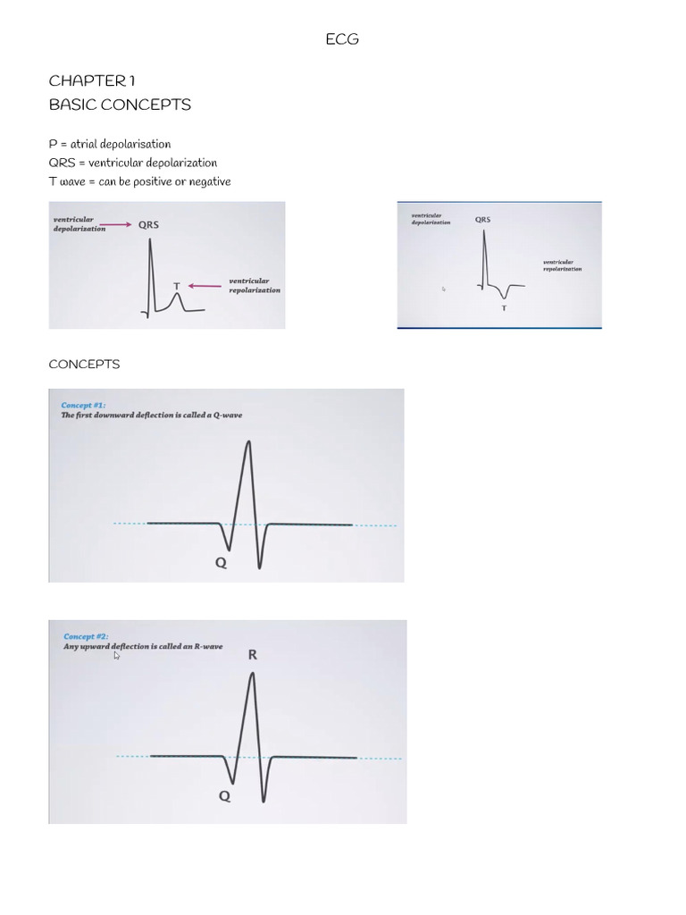 ECG Basic Concepts: P Atrial Depolarisation QRS Ventricular ...