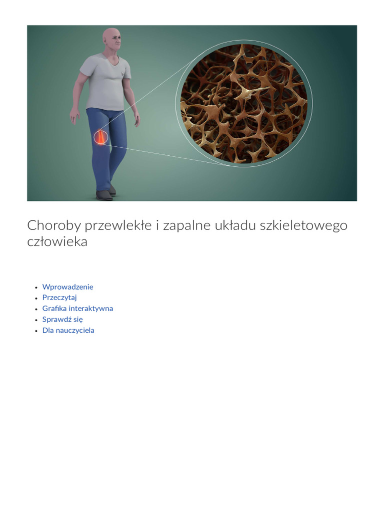 Choroby_przewlekle_i_zapalne_ukladu_szkieletowego_czlowieka | PDF