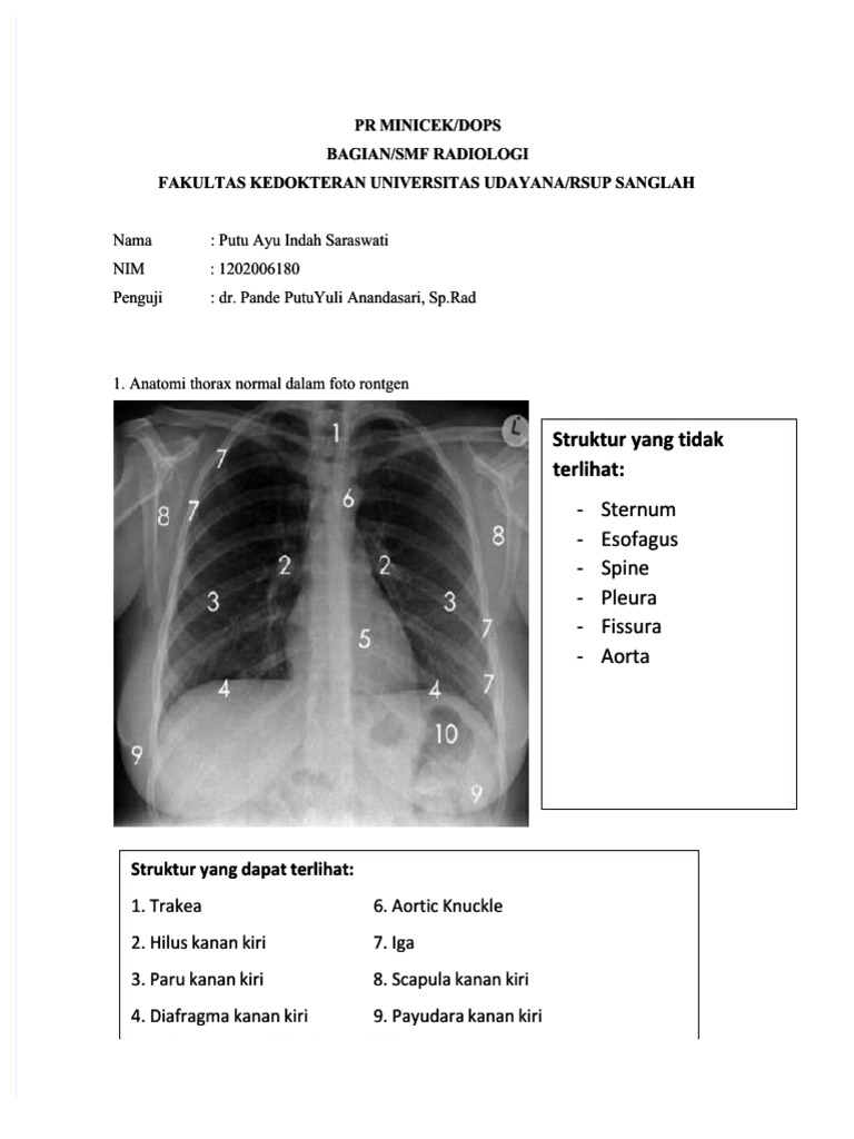 PDF Anatomi Thorax Normal Gambaran Radiologi Compress | PDF