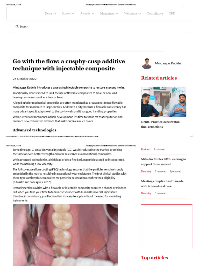 A Cuspby-Cusp Additive Technique With Composite - Dentistry | PDF ...