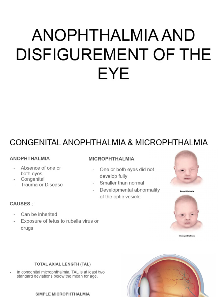 Anopthalmia and Disfigurement of The Eye | PDF | Ophthalmology | Human Eye