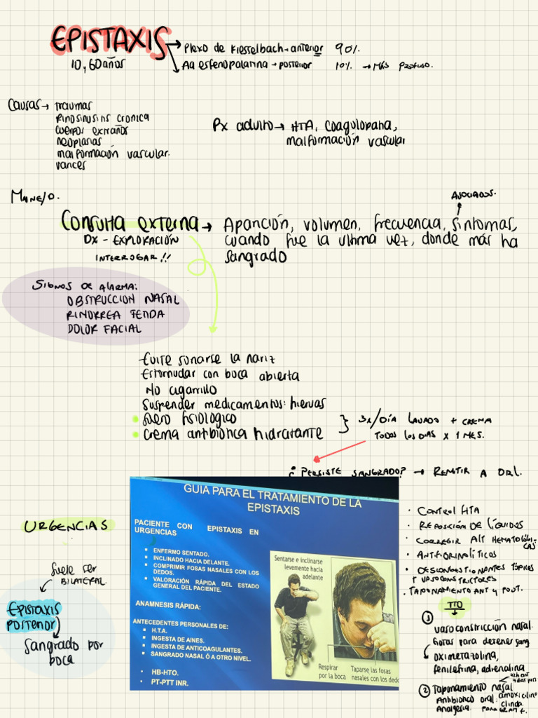 Epistaxis y Vertigo | PDF | Vértigo | Otorrinolaringología