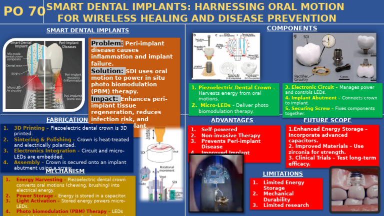 Smart Implants Poster (1) | PDF | Dental Implant | Medical Specialties