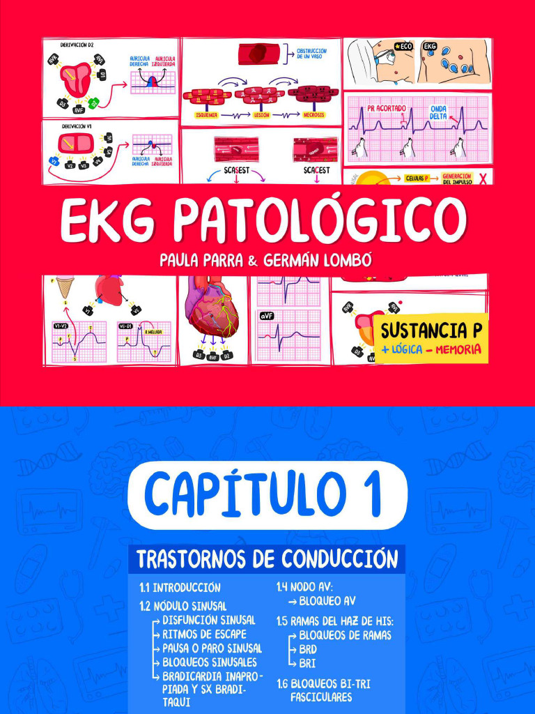 Demostración EKG Pat | PDF | Enfermedades cardiovasculares | Medicina ...