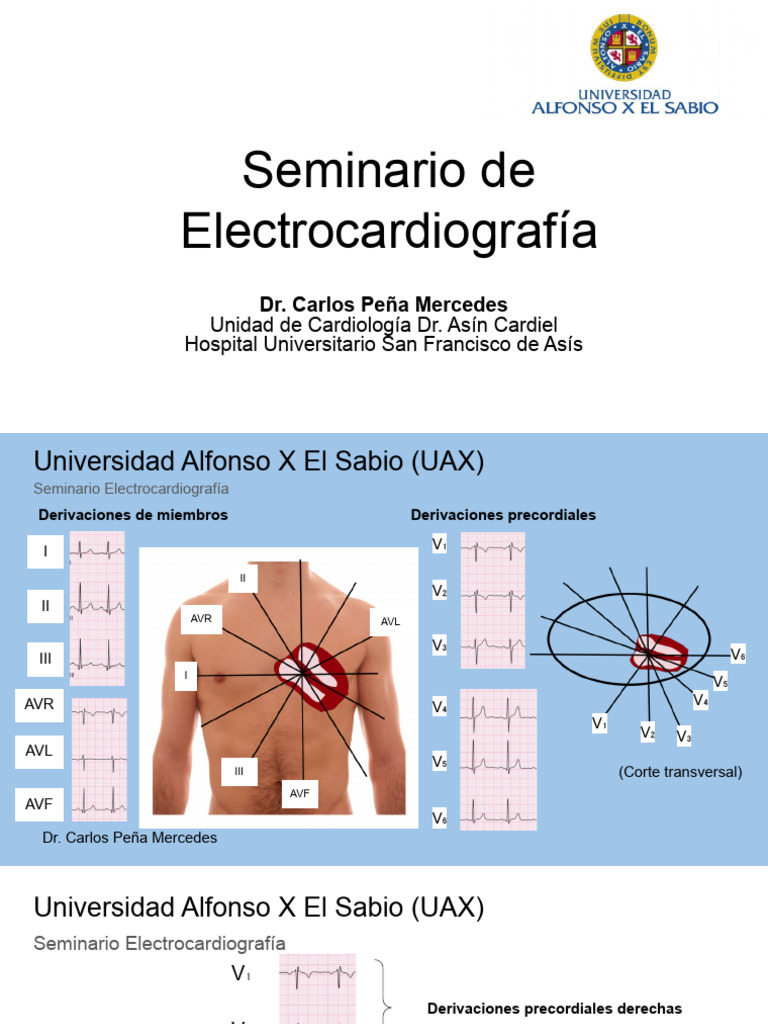 Sm2. ECG II | PDF | Electrofisiologia | Arritmia cardiaca