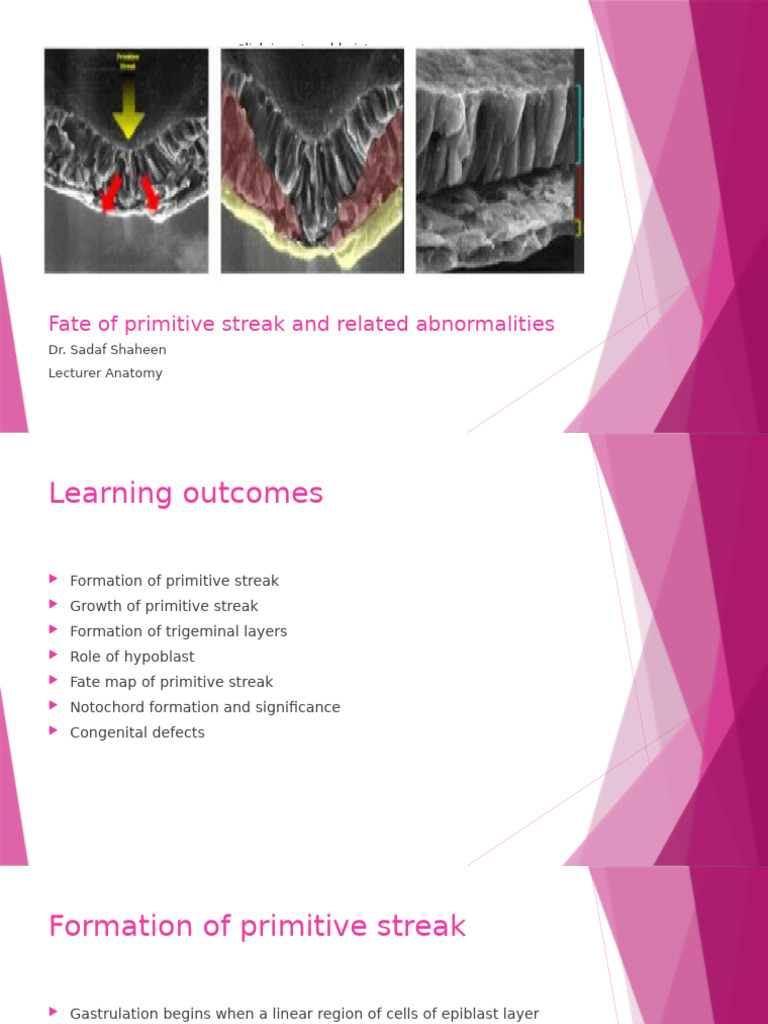 Primitive Streak Development and Abnormalities | PDF | Morphology ...