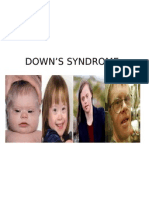 Down's, Edward's and Patau's Syndrome | PDF | Down Syndrome | Diseases ...