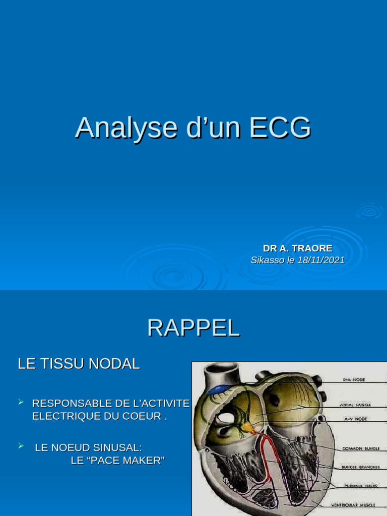 Analyse détaillée d'un ECG | PDF | Électrocardiographie | Médecine clinique